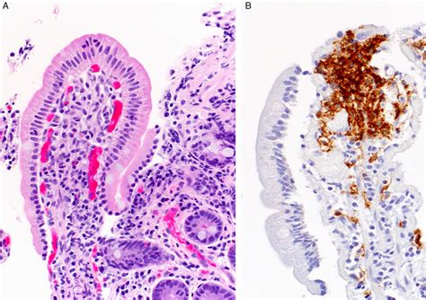 A A Very Subtle Single Aggregate Of Mast Cells In The Tip Of A Villus Download Scientific