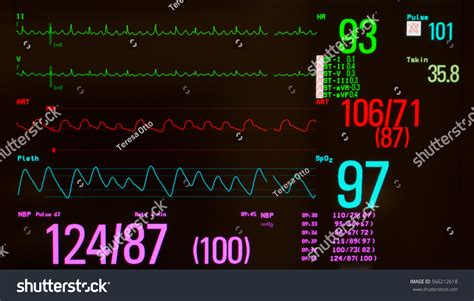 Atrial Flutter Images Browse Stock Photos Vectors Free Download With Trial Shutterstock