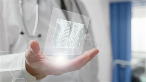 Doctor Analyzing Chest X Ray AI Stock Video Video Of Intelligence Innovation