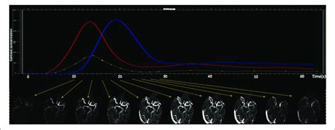 Generating Dynamic CTA Images Ten Continues CTA Images Were Manually Download Scientific