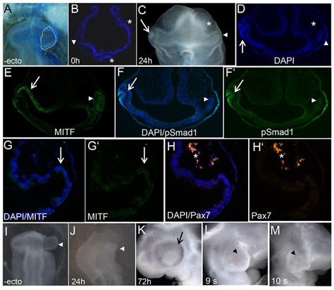 The Surface Ectoderm Is Required For Rpe Specification In The Chick Download Scientific