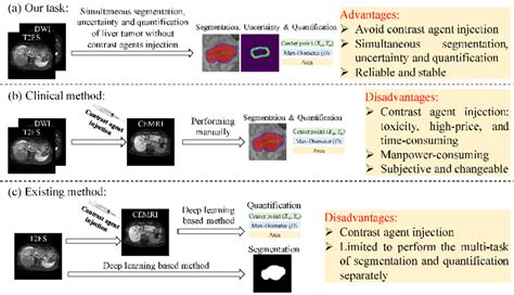 Our Method Integrates Segmentation And Quantification Of Liver Tumor