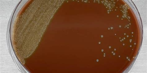 Streptococcus Suis Zenit