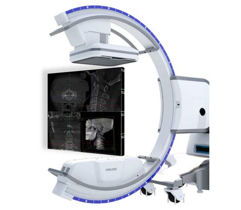 Two Technological Routes For Orthopedic Intelligent Robots The Difference Between 2d And 3d