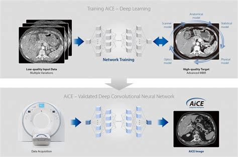 Deep Learning Reconstruction • Canon Medical Österreich
