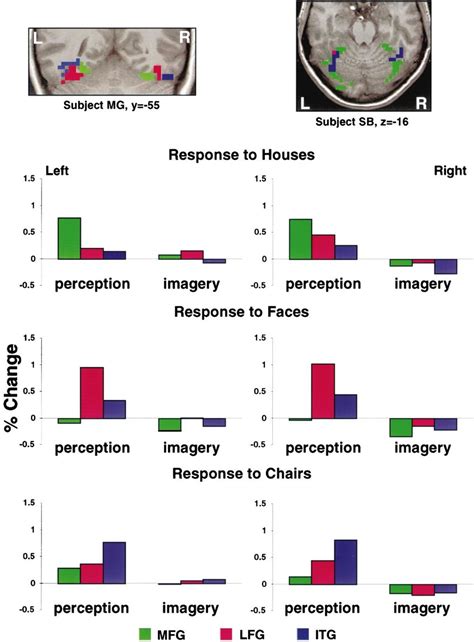 Response In Ventral Temporal Cortex During Visual Perception Of Houses Download Scientific