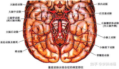 基底动脉 脑血管解剖 知乎