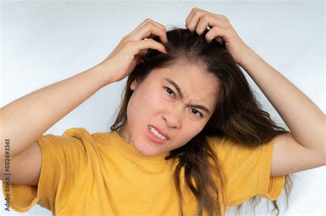 Asian Woman Scratching Her Scalp Caused Of Itchy Scalp Stock Photo Adobe Stock