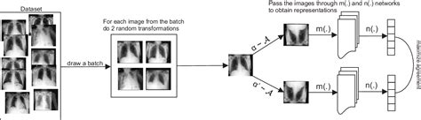Table 1 From Self Supervised Deep Convolutional Neural Network For Chest X Ray Classification
