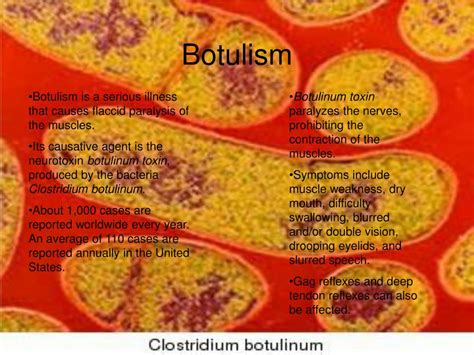 Ppt Botulism Powerpoint Presentation Free Download Id 6666626