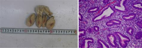 The Paraffin Pathology Of The Uterus A Uterus B Postoperative Download Scientific Diagram