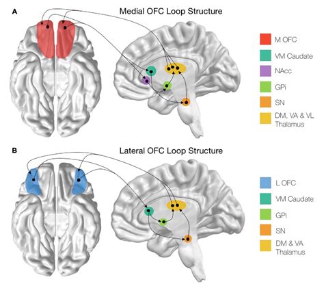 Orbitofrontal Cortex Ocd