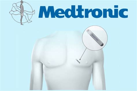 Medtronic Launches In Office Study Of Reveal Linq Heart Monitor MassDevice
