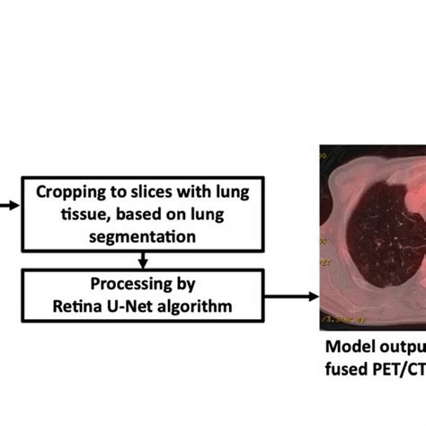 Schematic Data Processing Workflow Both The CT And PET Component Of Download Scientific