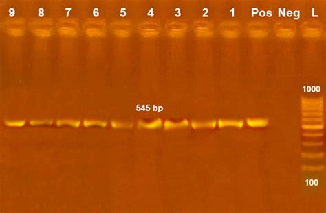 Uniplex Polymerase Chain Reaction Showing Positive Amplification Of Download Scientific Diagram