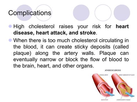 Hypercholesterolemia Ppt
