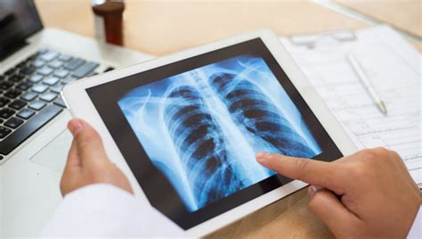 Lung Lobectomy Disease Trust Dr Shridhar For Expert Care