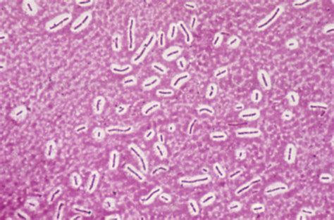 Pathogenic Bacteria Pictures Flashcards Quizlet