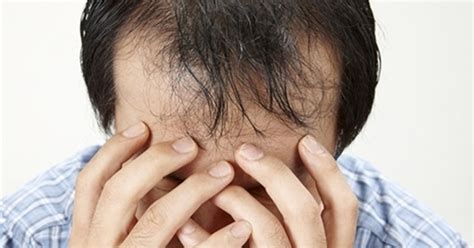 머리 감으면 뭉텅~빠지는 겨울철 탈모해결책은