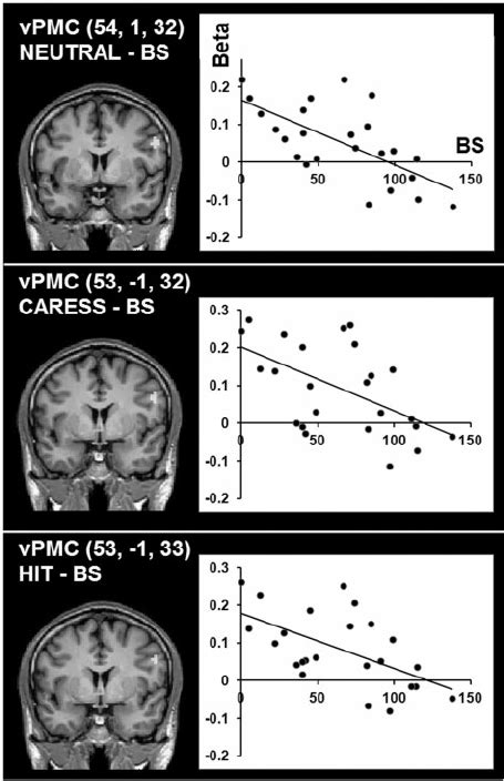 Correlation Between Social Skill Score X Axis And Bs Severity Y