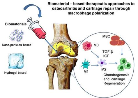 基于生物材料的骨关节炎和通过巨噬细胞极化修复软骨的治疗方法 The Chemical Record X Mol