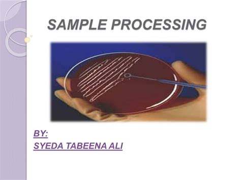 Microbiologica Samples Processing Pptx Microbiologica Samples Processing Pptx