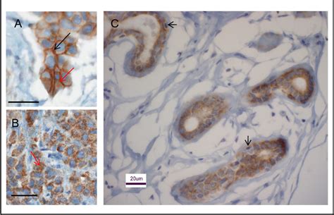 Tissue Microarray Analysis Semantic Scholar