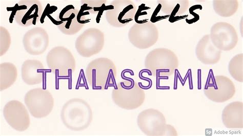 Target Cells Thalassemia