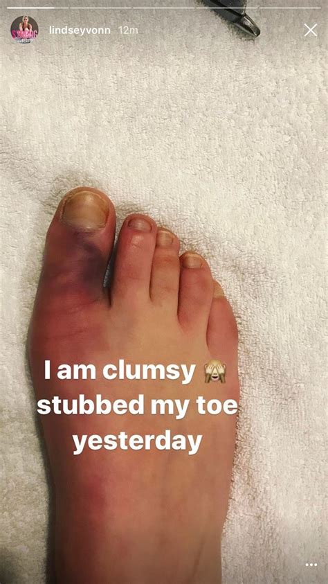 Lindsey Vonns Feet