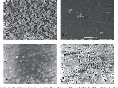 Figure 1 From Efficacy Of Different Irrigant Activation Systems On Debris And Smear Layer