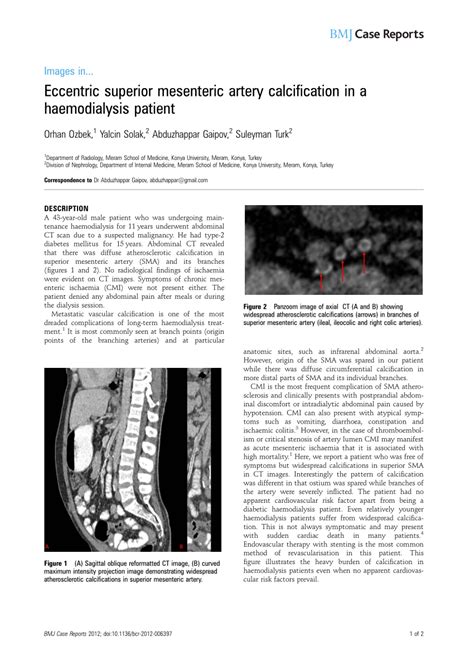 Pdf Eccentric Superior Mesenteric Artery Calcification In A Haemodialysis Patient