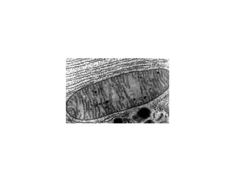 Electron Micrograph Mitochondrion Pdf