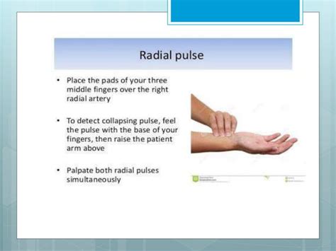 Assessing Radial Pulse Ppt