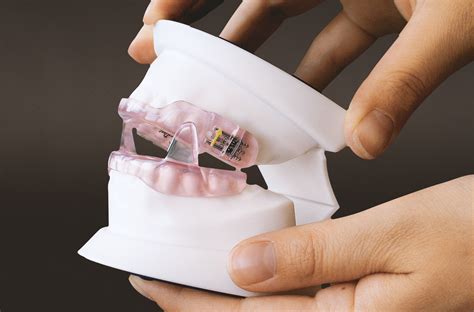 Somnomed Oral Appliance