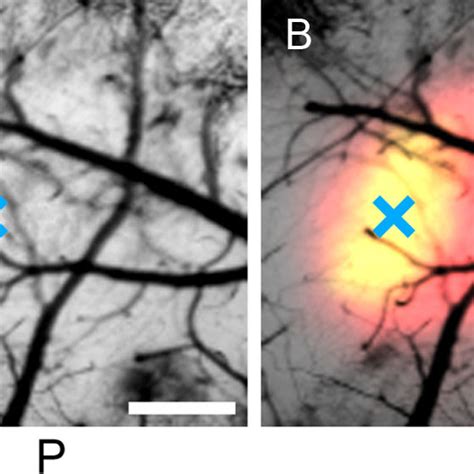 Optical Image Of Mouse Visual Cortex A Photograph Showing The Download Scientific Diagram