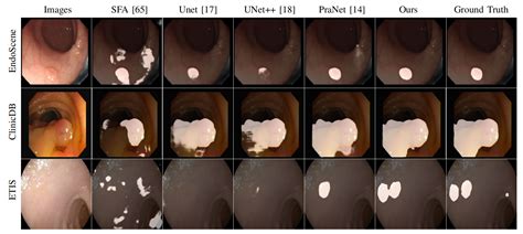 【论文阅读】mcanet Medical Image Segmentation With Multi Scale Cross Axis Attention Csdn博客
