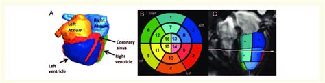 A A Posteroanterior View Of A Whole Heart Segmentation Showing Download Scientific Diagram