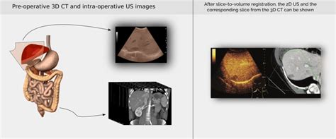 One Of The Main Applications Requiring Slice To Volume Registration Is Download Scientific