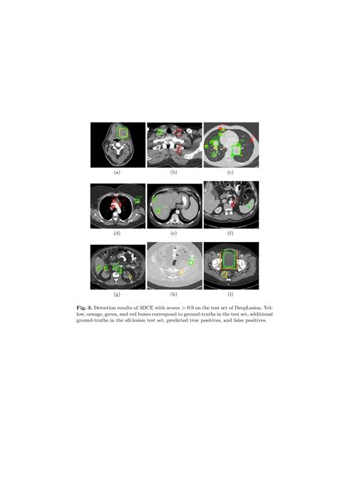 3d Context Enhanced Region Based Convolutional Neural Network For End To End Lesion Detection