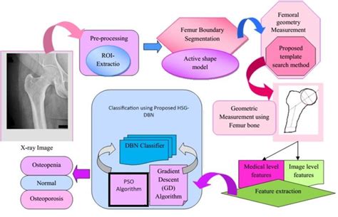 Block Diagram Of The Proposed Method Of Osteoporosis Classification