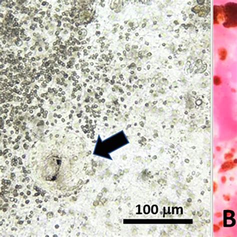 Unidentified Metacercariae From Coptodon Guineensis At Sebkha Imlili Download Scientific