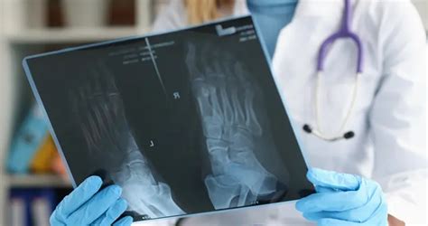 Joint Limb CT Scan In Delhi CT Scan Price Starting Qris Health