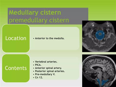 Basal Cisterns Final Ppt