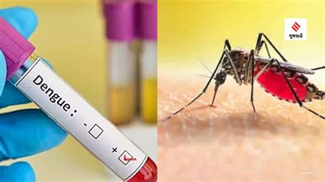 Dengue Cases ડેન્ગ્યુના કેસોમાં વધારો આટલી બાબતોનું ધ્યાન રાખવું જરૂરી