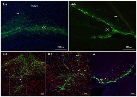 The Fate Of Nscs Two Weeks After Transplantation To The Hippocampus Download Scientific