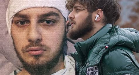 ორი წლის წინ რომ გავიღვიძე ბალიში იყო სისხლიანი ეს დაავადება მილიონში ერთს ემართება