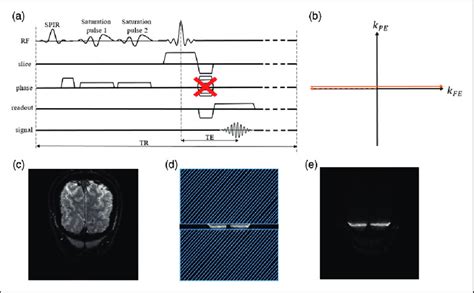 A Schematic Of The Gradient Echo Line Scanning Ge Line Sequence