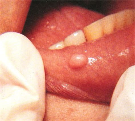 Practical Midterm 1 Flashcards Quizlet