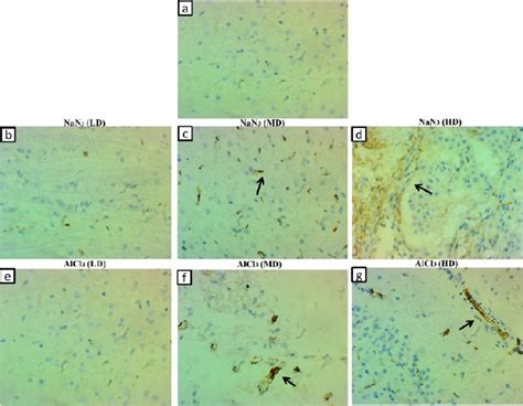 Immunohistochemistry Ihc Of Brain Tissue A Control Group Showed Download Scientific