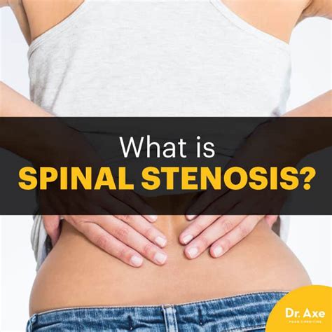 Spinal Stenosis Symptoms Causes And Treatments Dr Axe